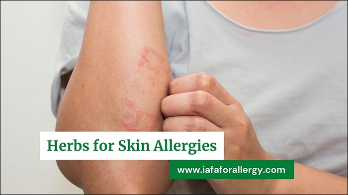 How To Get Rid Of Skin Allergies Naturally