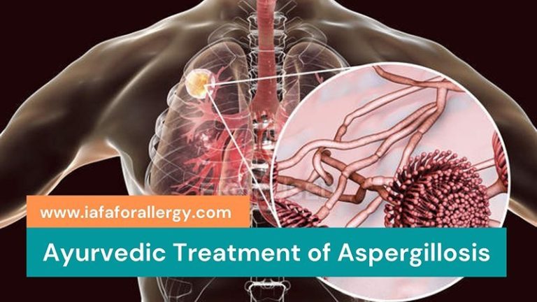 Aspergillosis: Types, Causes, Symptoms and Ayurvedic Treatment