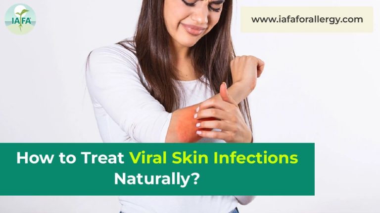 How to Treat Viral Skin Infections Naturally?
