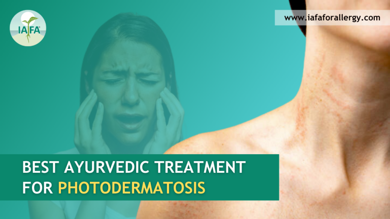 What is the Best Ayurvedic Treatment for Photodermatosis?