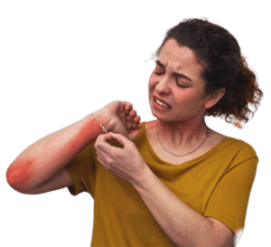 Nickel Allergy - Causes, Symptoms and Treatment