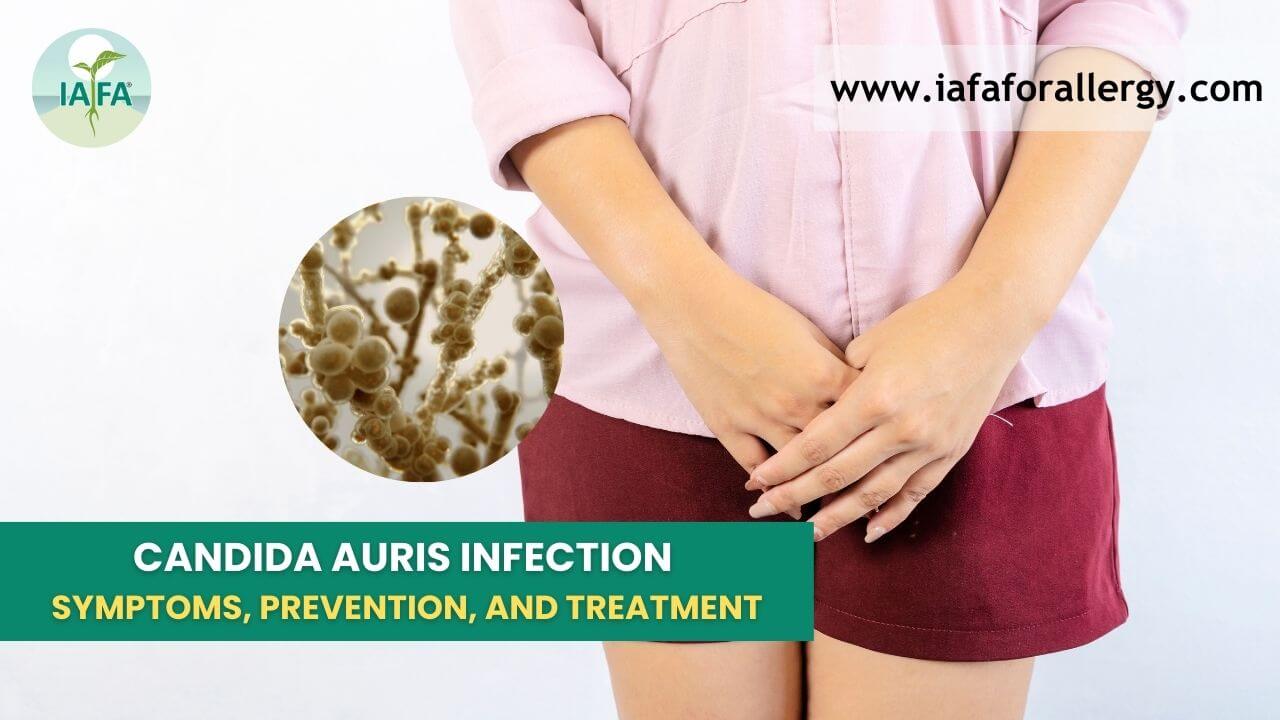 Top 10 Home Remedies to Prevent Fungal Groin Infection